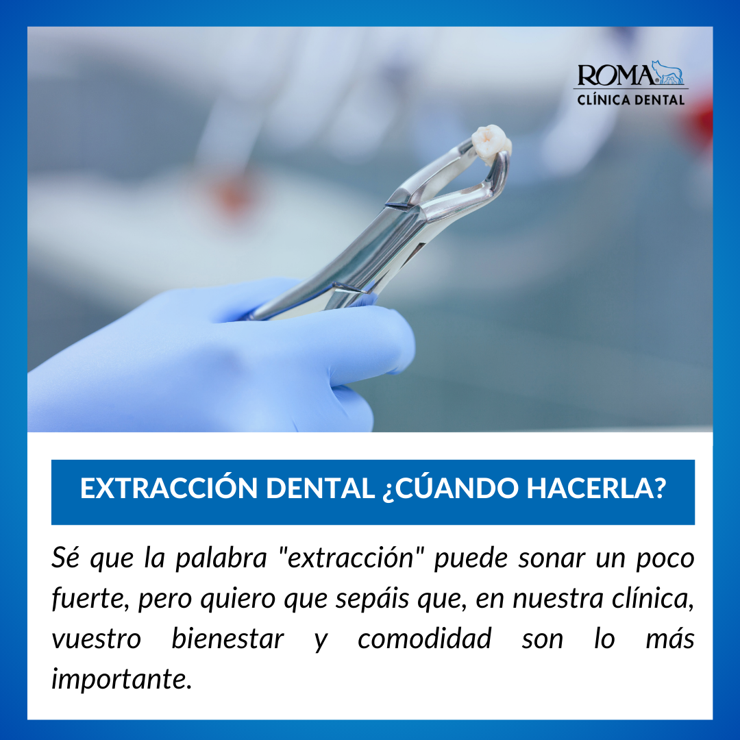 ¿Cuándo quitar un diente? Exodoncia extracción dental